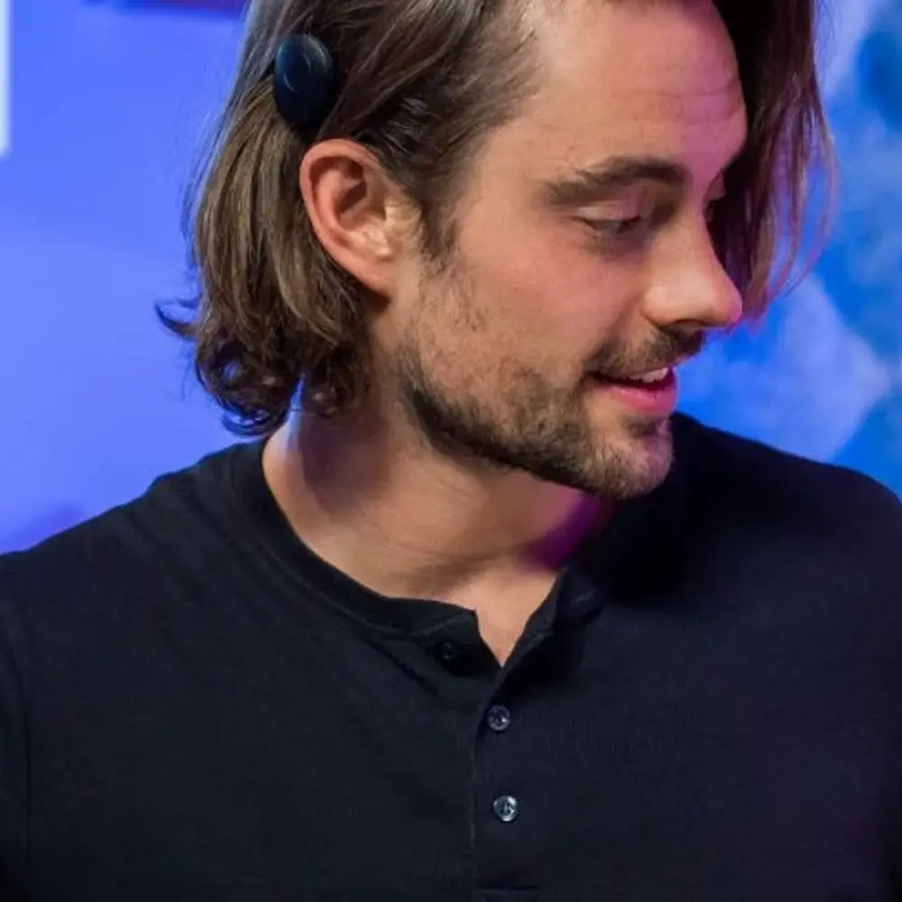 VIBRANT SOUNDBRIDGE – MIDDLE EAR IMPLANT